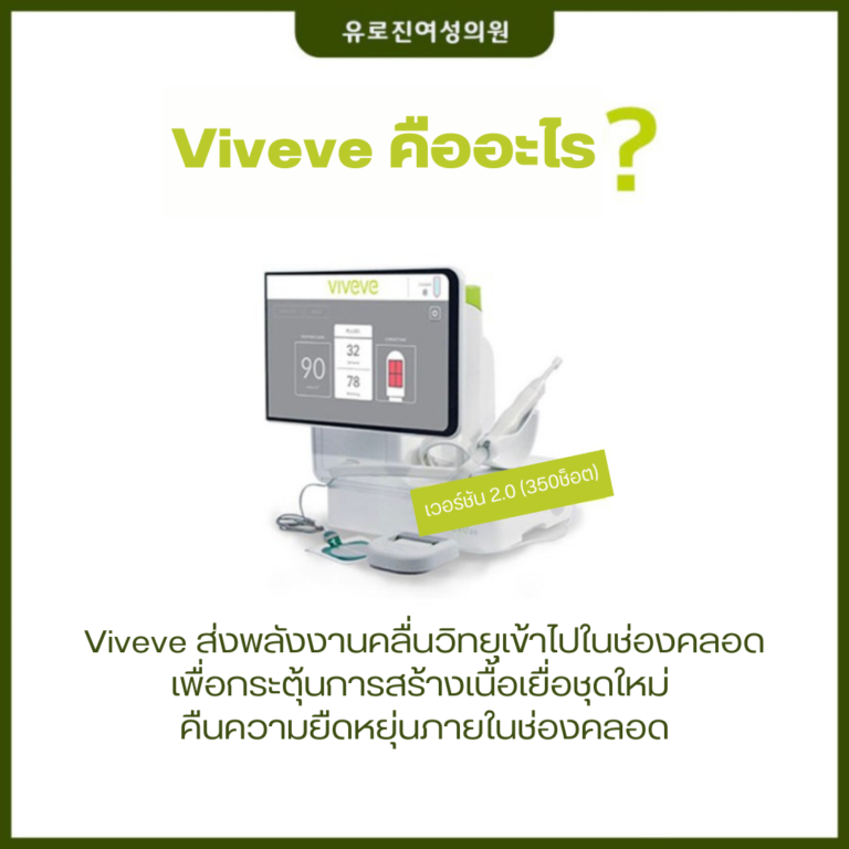 นวัตกรรมกระชับช่องคลอด VIVEVE ฟื้นฟูความฟิต - STMstyle
