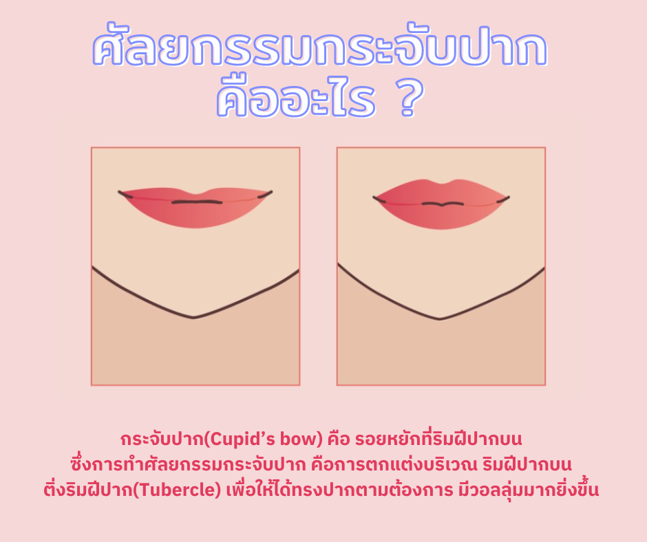 Things to know before getting chestnut lips Why do it in Korea? - STM Style