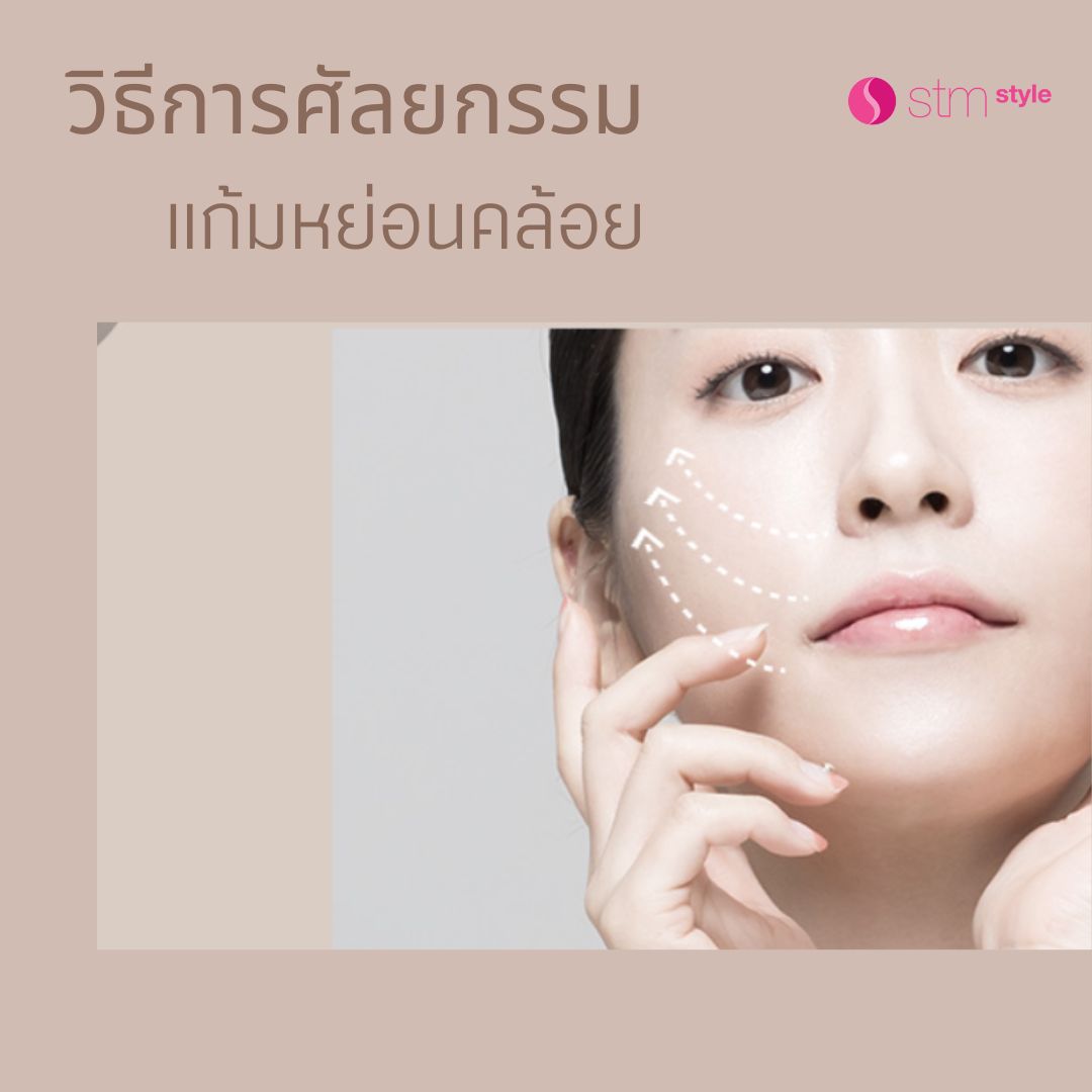 Sagging Cheek Surgery Method - STM Style