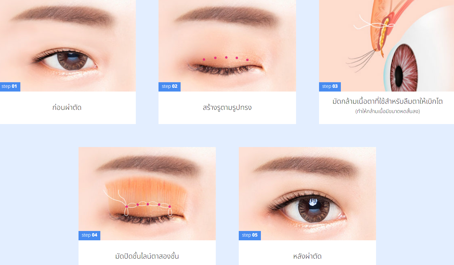 Male eyelid surgery - STM Style