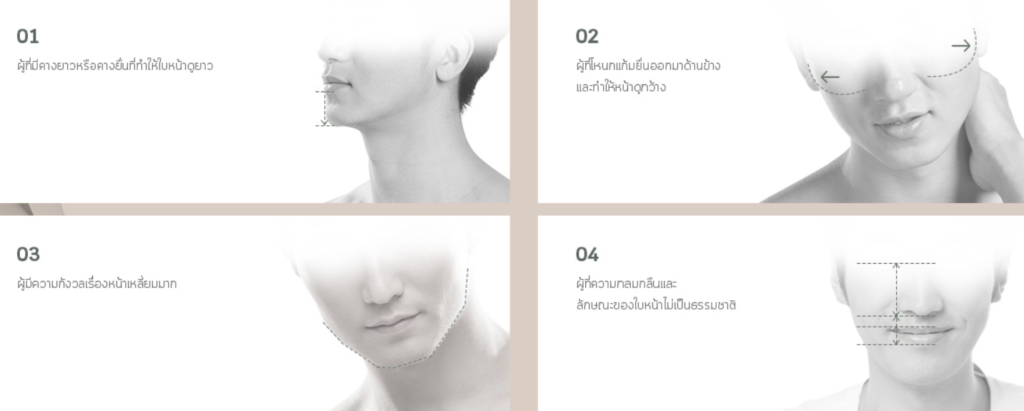 facial contouring surgery for men - STM Style