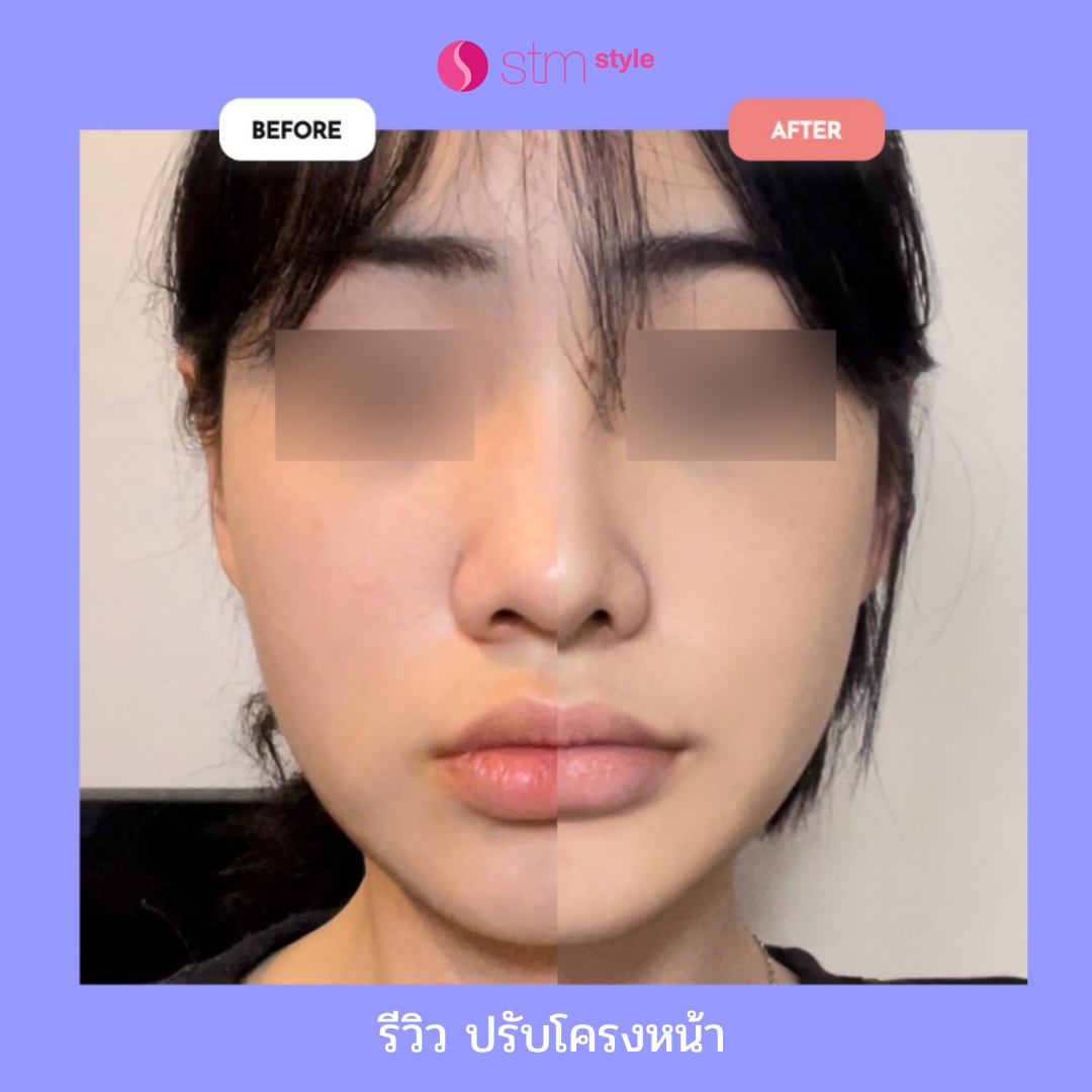 AB Plastic Surgery / facial contouring surgery - STM Style