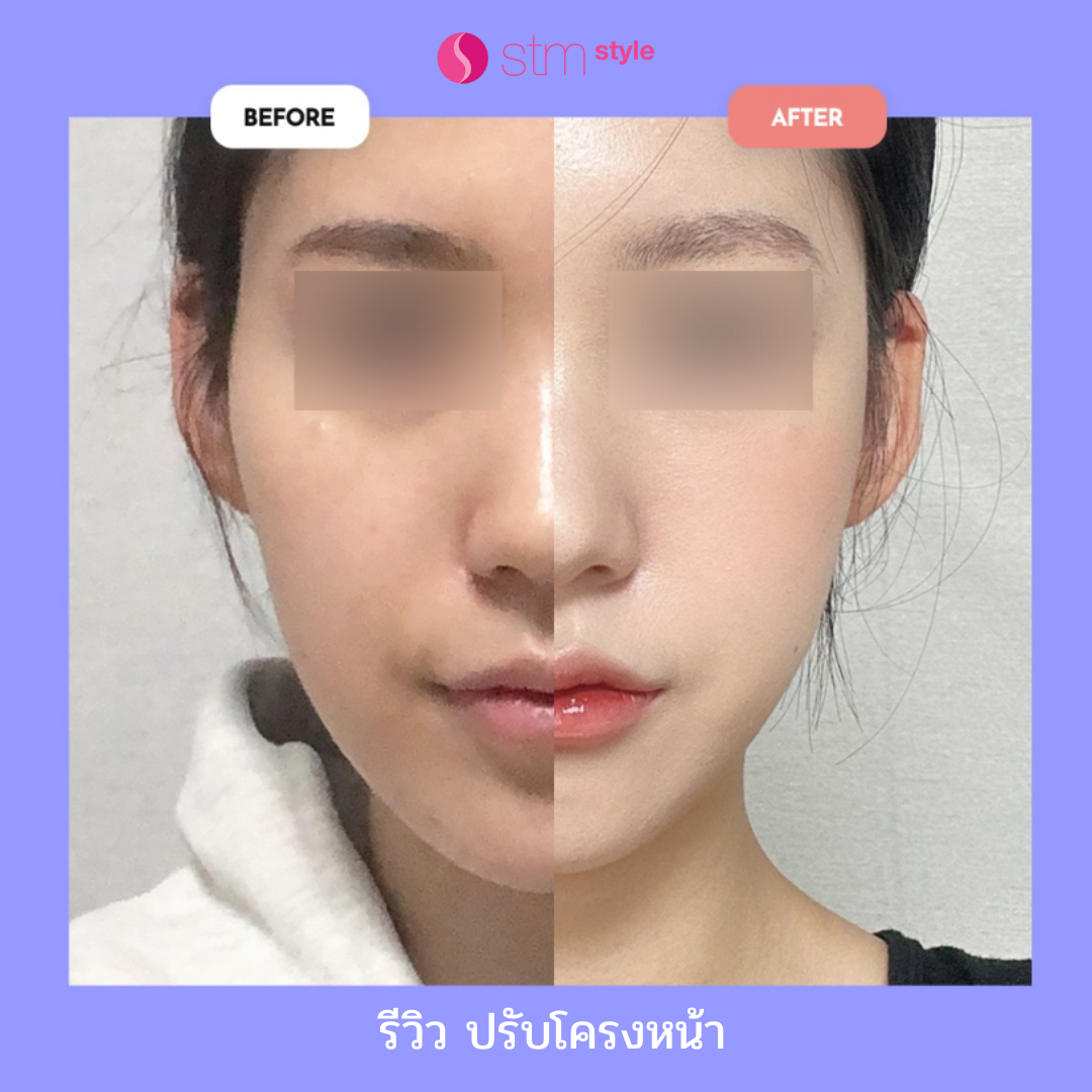 AB Plastic Surgery / facial contouring surgery - STM Style